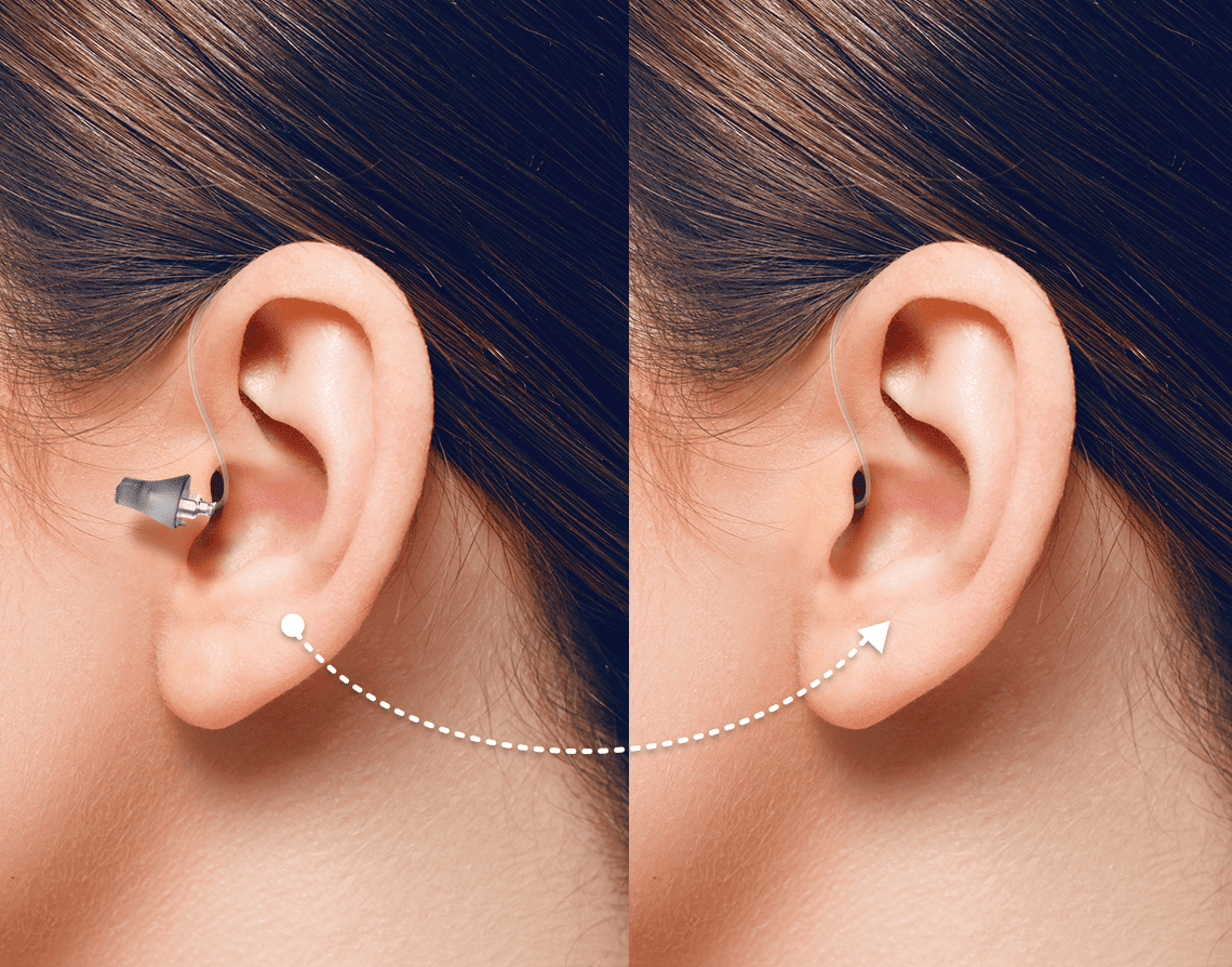 Hearing Aids - Hear.com ZA