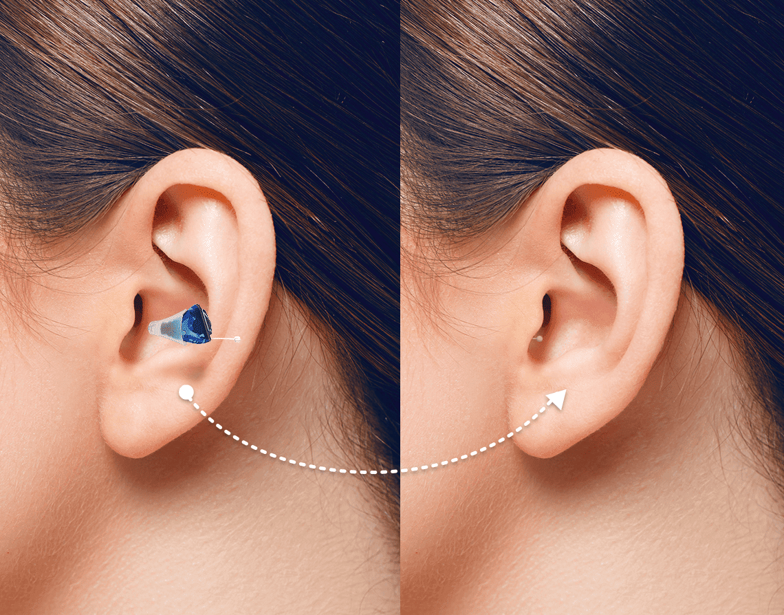 Hearing Aids - Hear.com ZA